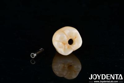 China Precision Titanium Finished Abutments with Zero Angulation and Internal Hex Connection for Dental Implants for sale
