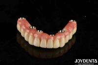 China Dental Titanium Malo Implant Bridge Combining Traditional And Modern Techniques for sale