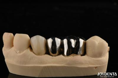 China Abrasion Resistant Metal Alloy Crown For Customized Dental Restorations for sale