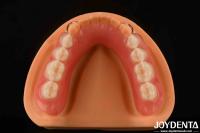 China Personalized Customization Acrylic Denture Finish Lightweight High Elasticity for sale