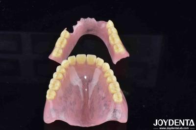 China High Elasticity Flexible False Teeth Finished For Personalized Customizations for sale