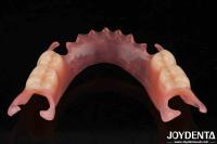 China Comfortable Fit Dental Flexible Denture Finish With High Stealth Diverse Materials for sale