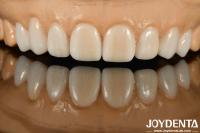 China High Stealth Diverse Materials Of Metals And Resins Flexible Denture Finish For Advanced Stealth Technology for sale