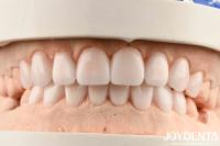 China Diverse Materials And Good Elasticity In Flexible Denture Finish For Metals And Resins for sale