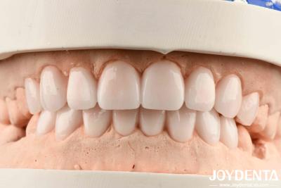 China Diverse Materials And Good Elasticity In Flexible Denture Finish For Metals And Resins for sale
