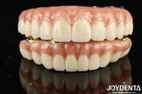 China High Durability Ti-Bar Zirconia Hybrid Bridge For Achieving Aesthetics for sale