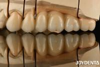 China White Full Zirconia With High Resistance To Thermal Shock High Strength for sale