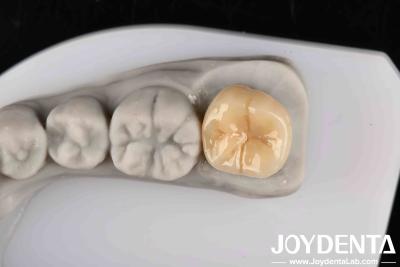 China High Resistance To Thermal Shock And Corrosion Full Zirconia With Excellent Chemical Stability for sale