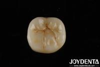 China High Translucency Full Zirconia With Layers Biocompatibility And Flexural Strength Of 800 MPa for sale