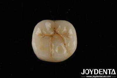 China High Translucency Full Zirconia With Layers Biocompatibility And Flexural Strength Of 800 MPa for sale