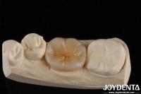 China 800 MPa Flexural Strength And 8 MPa·m1/2 Fracture Toughness In Multilayer Full Zirconia For Strength Applications for sale