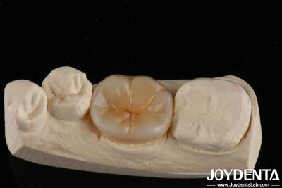 China 800 MPa Flexural Strength And 8 MPa·m1/2 Fracture Toughness In Multilayer Full Zirconia For Strength Applications for sale