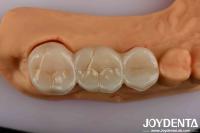 China High Strength Dental Zirconia Your Ultimate Solution For Natural-looking Esthetics for sale