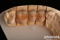 China High Chipping Resistance And Natural-looking Esthetics With Multilayer Full Zirconia Technology for sale