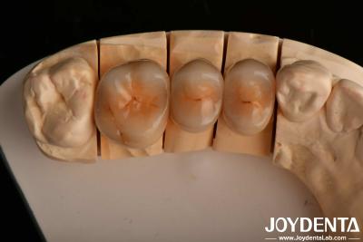China High Chipping Resistance And Natural-looking Esthetics With Multilayer Full Zirconia Technology for sale