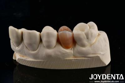 China Biocompatible And Natural-looking Multilayer Full Zirconia With Esthetics for sale