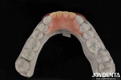 China Take Your Dental Practice To Next Level Flexible Denture Finish With Natural Tooth Morphology And Personalized Customization for sale