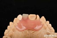 China High Stealth Good Elasticity Flexible Denture Finish For Diverse Manufacturing Processes for sale