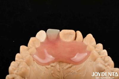 China High Stealth Good Elasticity Flexible Denture Finish For Diverse Manufacturing Processes for sale