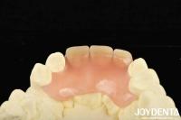 China Revolutionize Your Dental Practice with Lightweight and Diverse Products for sale