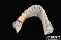 China Stable Oral Structure For Dental Professionals In Firmly Connect The Row Teeth for sale