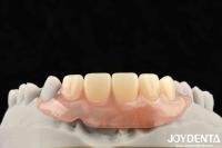 China Elaborate Technology Framework Set Up Teeth Finish For Stable Oral Structure In Dental Technology Apply To Dental for sale