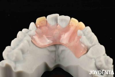 China Stable Oral Structure Effect Framework Set UP Teeth Finish Beautiful And Harmonious Appearance Design for sale