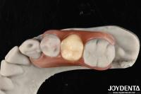 China Revolutionize Your Dental Practice  Framework Set Up Teeth Finish With Elaborate Technology From Dental for sale
