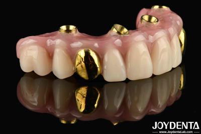 China 50ml Dentwre From United States Your Ultimate Solution Ti-Bar Acrylic Teeth Finish For Dental Treatment for sale