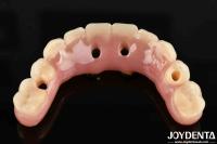 China 50ml Ti-Bar Acrylic Teeth Finish 24 Hours Curing Time United States For Dental Professionals for sale