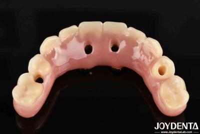 China 50ml Ti-Bar Acrylic Teeth Finish 24 Hours Curing Time United States For Dental Professionals for sale