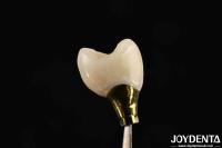 China Various Sizes Implant Crown And Bridge For Strong Dental Implants Compatibility for sale
