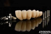 China Experience  Ultimate Esthetics With Aesthetically Pleasing Dental Implant Crown And Bridge for sale