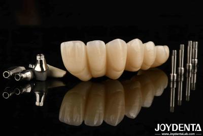 China Experience  Ultimate Esthetics With Aesthetically Pleasing Dental Implant Crown And Bridge for sale