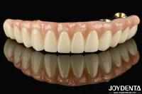 China Ti-Bar Zirconia Hybrid Bridge Compatible With Natural Teeth And Gums Autobiography Restoring Chewing Function for sale