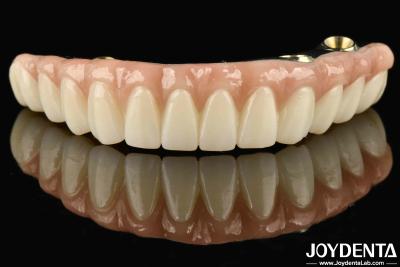 China Ti-Bar Zirconia Hybrid Bridge Compatible With Natural Teeth And Gums Autobiography Restoring Chewing Function for sale