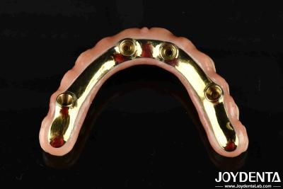 China Comfortable To Wear Ti-Bar Restores Chewing Function Essential Ti-Bar Zirconia Hybrid Bridge For B2B Transactions for sale