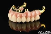 China Restoring Chewing Function Ti-Bar Zirconia Hybrid Bridge With High Biocompatibility And Precise Fit for sale