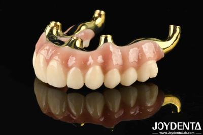 China Restoring Chewing Function Ti-Bar Zirconia Hybrid Bridge With High Biocompatibility And Precise Fit for sale
