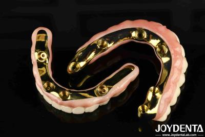 China Custom Made Excellent Strength Zirconia Hybrid Bridge Perfect Fit For Your Manufacturing Needs for sale