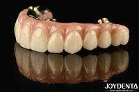 China Custom-made Ti-Bar Zirconia Hybrid Bridge Resistant To Corrosion And Wear Restoring Chewing Function With Precision for sale