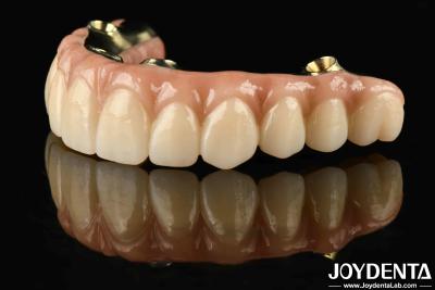 China Custom-made Ti-Bar Zirconia Hybrid Bridge Resistant To Corrosion And Wear Restoring Chewing Function With Precision for sale