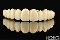 China Custom-made Ti-Bar Zirconia Hybrid Bridge The Perfect Combination For Comfort And Functionality for sale