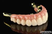 China Say Goodbye To Missing Teeth With Zirconia Natural-looking And Durable for sale
