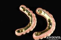 China Natural-looking Aesthetics Zirconia Hybrid Bridge With High Durability And Biocompatibility Ti-Bar Zirconia Hybrid Bridge for sale