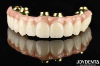 China Highly Durable And Long-lasting Ti-Bar Zirconia Hybrid Bridge With Corrosion And Wear Resistance for sale