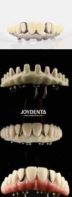 China Dental Aesthetic Titanium Malong Hybrid Bridge Ultimate Solution For Dental Restorations for sale