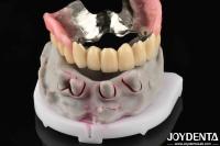 China Advanced Dental Metallic Material For Supporting Mastication Needs for sale