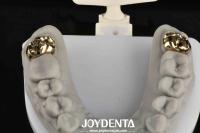 China Oral Rehabilitation With Dental Achieve Brighter And Healthier Smile for sale