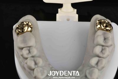 China Oral Rehabilitation With Dental Achieve Brighter And Healthier Smile for sale